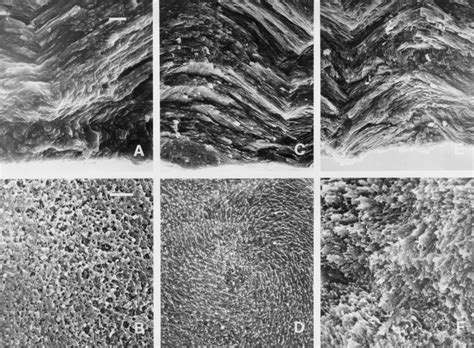Scanning Electron Micrographs Of Radial Fracture A C And E Same