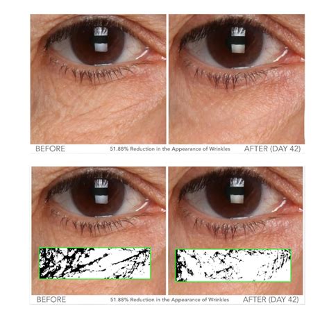 Serious Skincare Tratamento De Beleza Para Os Olhos Com Creme De