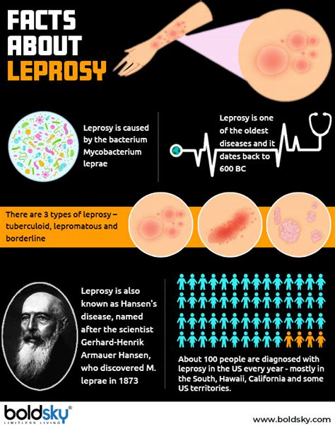 Leprosy Types Causes Diagnosis And Treatment