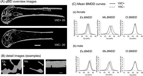 Vitamin C Deficiency Deteriorates Bone Microarchitecture And