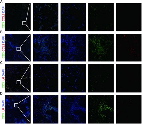 Immunofluorescence Detection Of Il6 Ccl2 And T Cell Expression A B