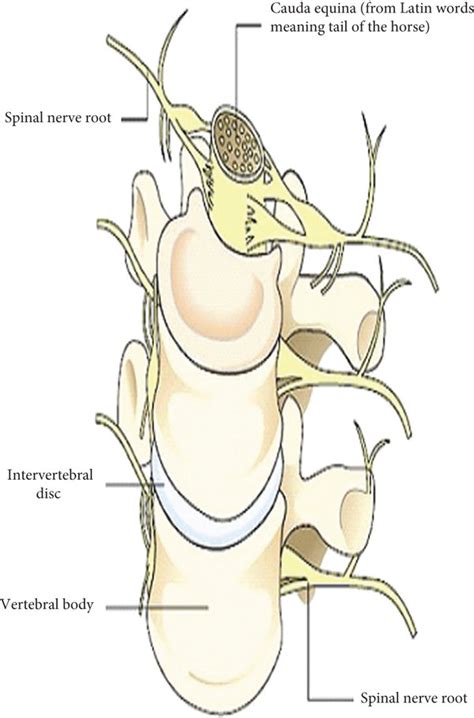 A Normal Intervertebral Disc And Spinal Nerve Root B Degenerated Download Scientific
