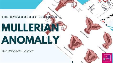 Mullerian Anomaly Concept And Classfication Youtube