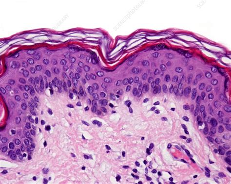 Skin Epidermis Light Micrograph Stock Image C0394787 Science