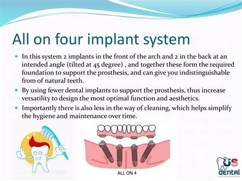 All On Four Dental Implant System Pptx