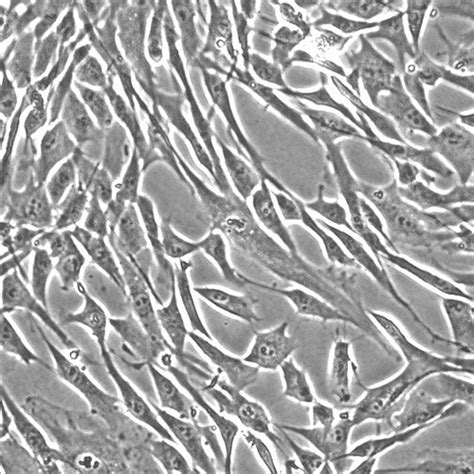 Human Bladder Stromal Fibroblasts Cells Online
