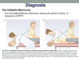 Benign Paroxysmal Positional Vertigo Bppv Pptx