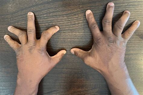 Jeff Herrod Feels Forgotten ‘no One Acknowledges The Work We Did