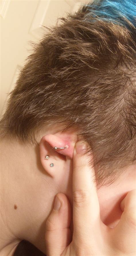 Does My Helix Look Right R Piercing