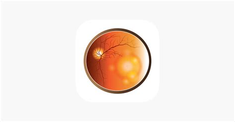 ‎app Store 上的“amd And Anti Vegf Therapy”