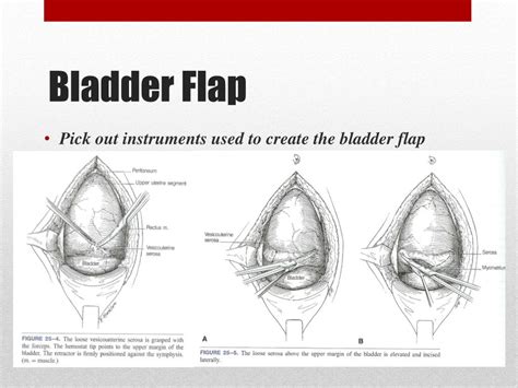 Ppt C Section Technique Powerpoint Presentation Free Download Id