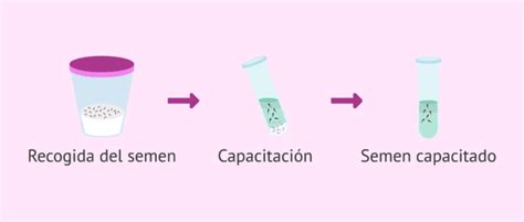 Procesamiento De La Muestra Seminal