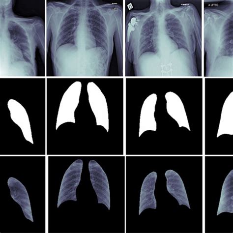 Proposed Stacking Model Architecture Download Scientific Diagram