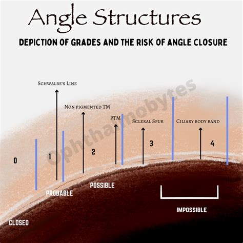 Shaffer Grading Gonioscopy — Ophthalmobytes