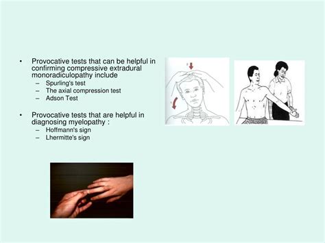 Ppt Physical Examination Of The Spesific Joints Powerpoint