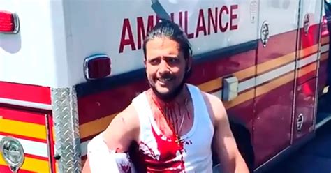 Defendió A Una Mujer Y Fue Apuñalado En La Cabeza Un Video Muestra Al