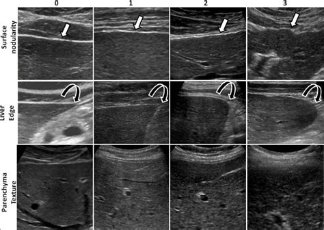 Examples Of Ultrasound Images From Different Patients Illustrating The Download Scientific
