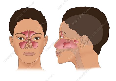 Sinus Anatomy Illustration Stock Image C0366312 Science Photo