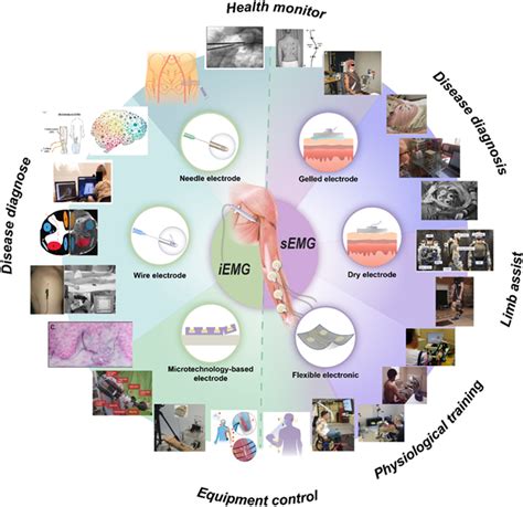 A Monopolar Needle Electrode B Concentric Needle Electrode C
