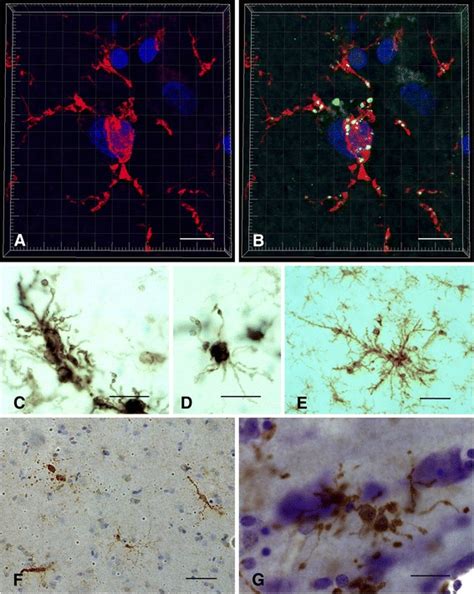 Microglial Pathology Pmc