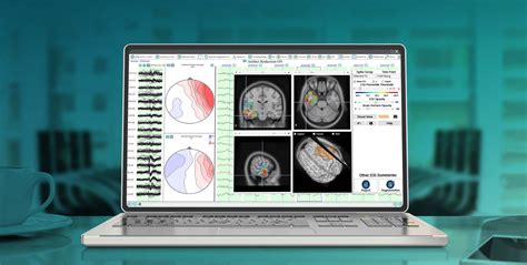 Persyst Esi Powered By Epilog Persyst