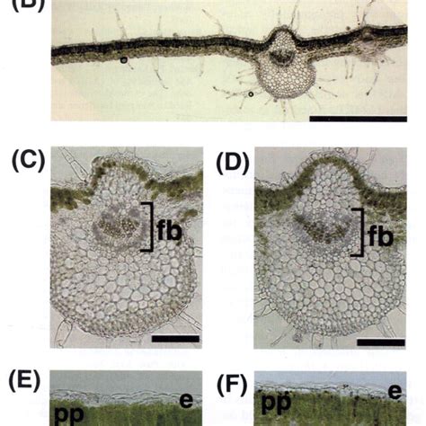 Longitudinal Leaf Sections Of Wild Type Tobacco And Transgenic Line 62