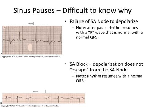 Ppt Chapter 2 Ecg Powerpoint Presentation Free Download Id 3359044
