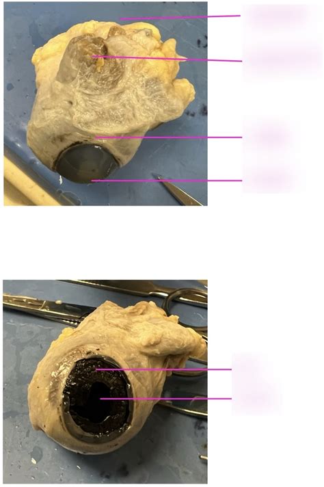 11 Eye Dissection Outer Diagram Quizlet