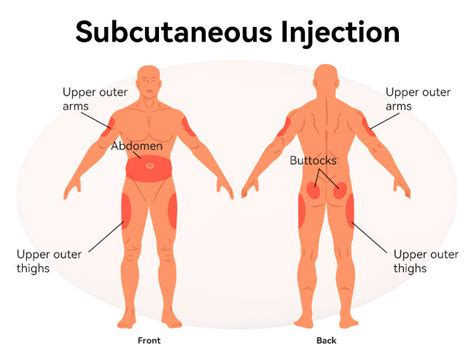 How To Give Subcutaneous Injection Practice Before Performing