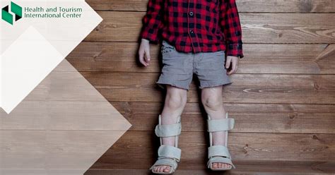 What Is Rickets Hti Centers Medical Tourism Center