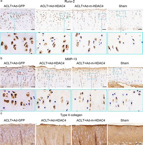 Runx 2 A And Mmp 13 B Ihc Staining Was Increased In Rats That