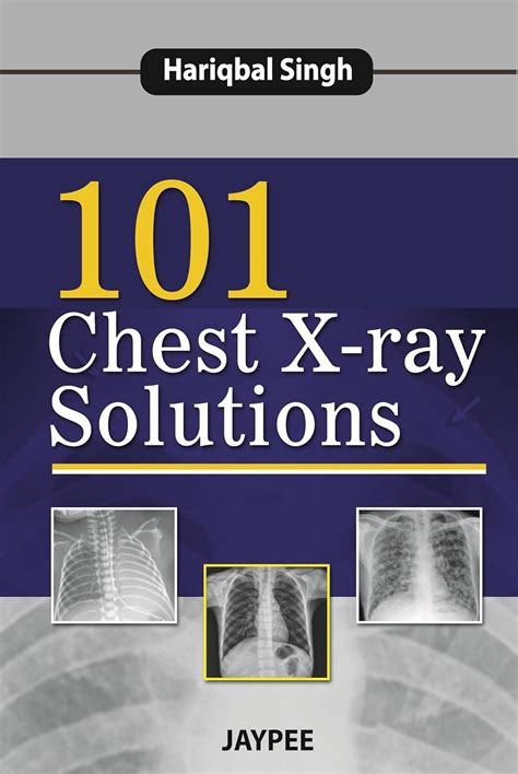 Chest X Ray Guide Book 101 X Ray Solutions