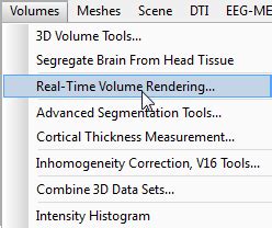 Real Time Volume Rendering