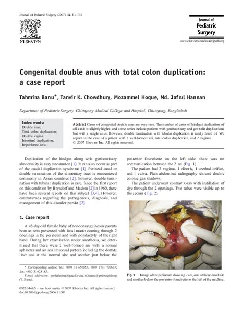 Pdf Congenital Double Anus With Total Colon Duplication A Case Report