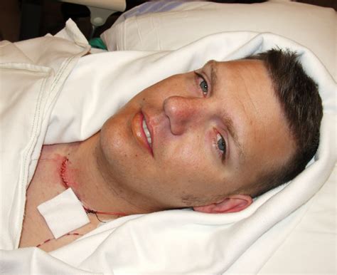 Mccallum Memoirs Hemithyroidectomy Surgery