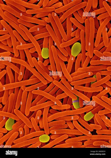 Coloured Scanning Electron Micrograph Sem Of Clostridium