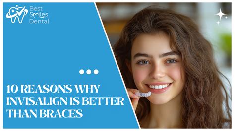 10 Reasons Why Invisalign Aligners Are Better Than Traditional Braces