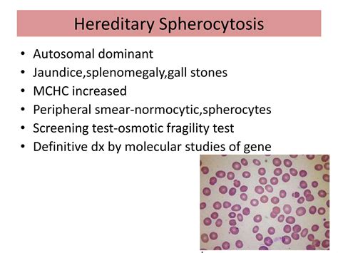 Diagnosis Of Anemia Pptx