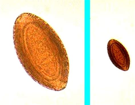 Chapter 9 The Phylum Acanthocephala Flashcards Quizlet