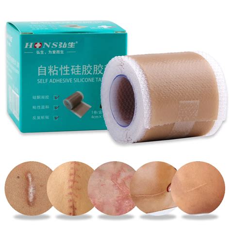 실리콘 흉터 패치 상처 밴드 여드름 화상 흉터 치료 커버 귀 교정기 효율적인 복구 손상된 피부 시트 4x50cm