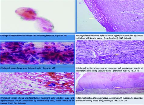 Cytological Versus Histopathology Picture Download Scientific Diagram