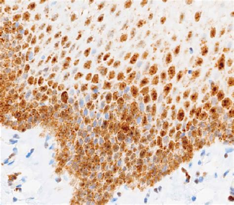 Enzo Announces Collaboration With Roche Diagnostics France For The