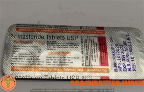 Balpecia 1mg Tab Packaging Size 110 At ₹ 30stripe In Nagpur Id