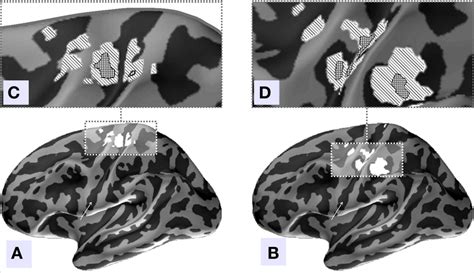 Source Localization Of The Two Independent Components With The Largest
