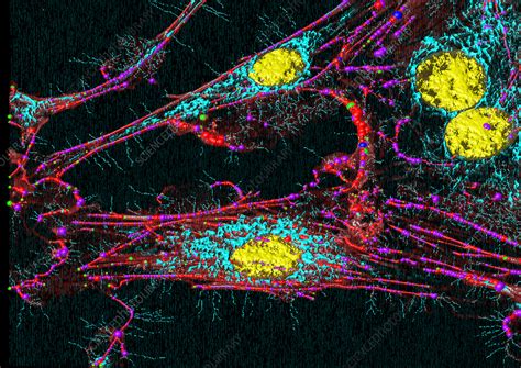 Fibroblast Cells Light Micrograph Stock Image C062 5029 Science Photo Library