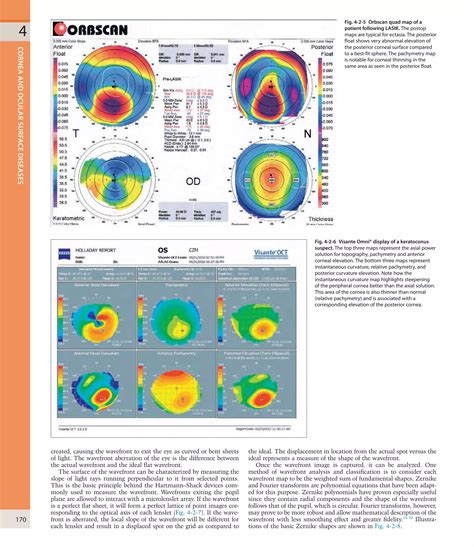 Corneal Topography And Wavefront Imaging Pdf