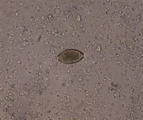 Egg Of Parasite In Stool Examition Testing Stock Image Image Of Cell