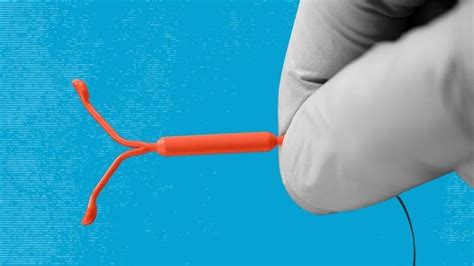How To Quickly Lose Weight After Mirena Iud Removal Everything You