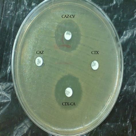 Frequency Of Phenotypic Esbl Positive And Esbl Negative Download Table