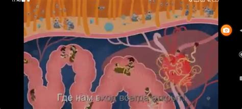 Create Meme Cartoon Helminths Atrophic Gastroduodenitis The